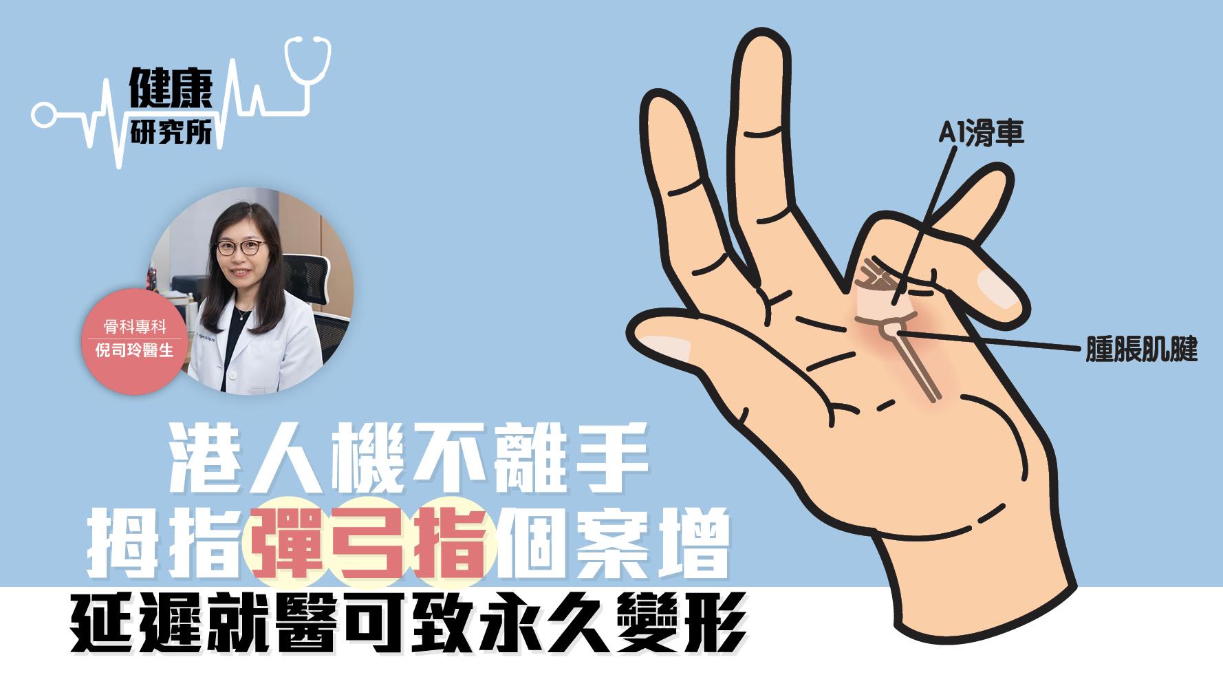 健康研究所｜港人機不離手 拇指「彈弓指」個案增 延遲就醫可致永久變形 | am730